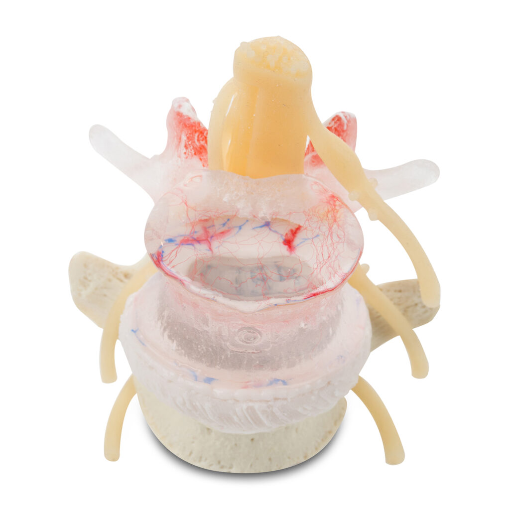 Professional Lumbar Dynamic Disc model | Spine Store